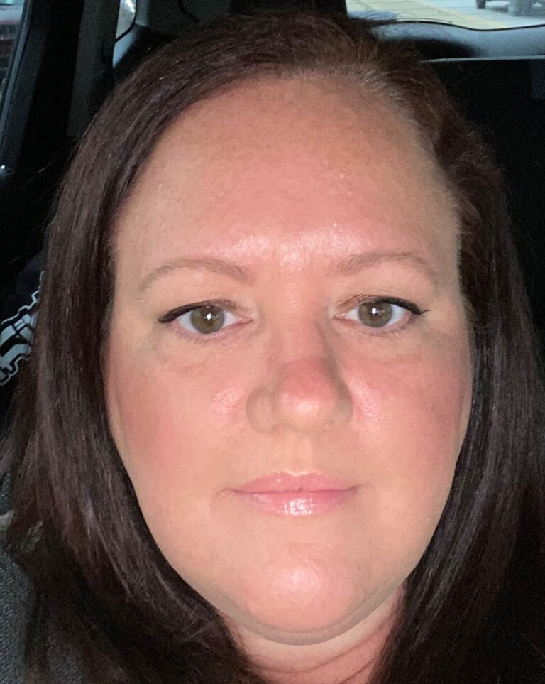 Christie Conley | Cancer Care | Louisville KY | UofL Health